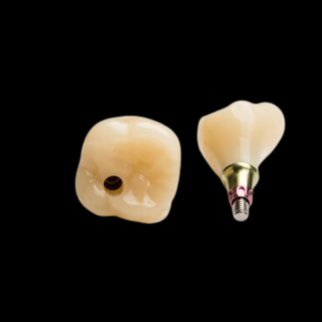 DENTAL IMPLANTS – Hillstone Dental Lab